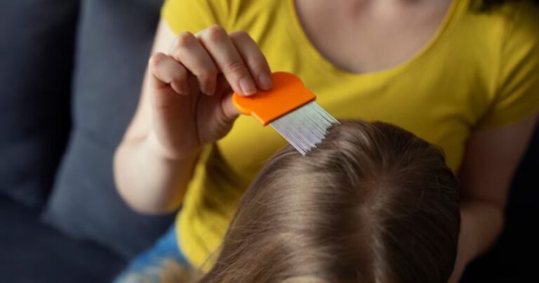 What Do Lice Nits Look Like?