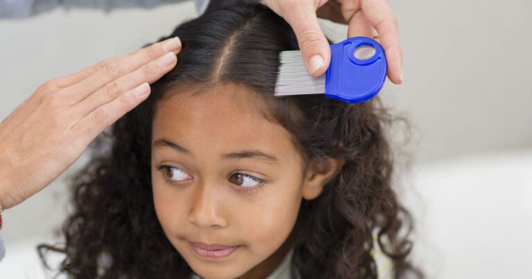 Head Lice Prevention: What Works and What Doesn’t