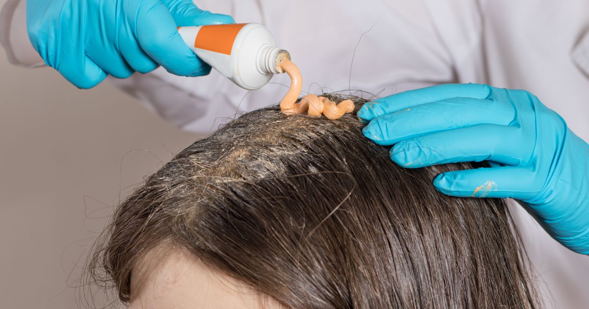 How to Use Lice Repellent Safely and Effectively