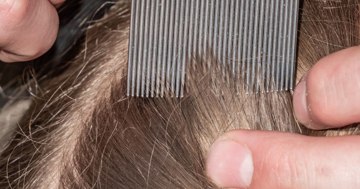 Can You Get Lice From Not Washing Your Hair? Facts and Myths | The Lice ...